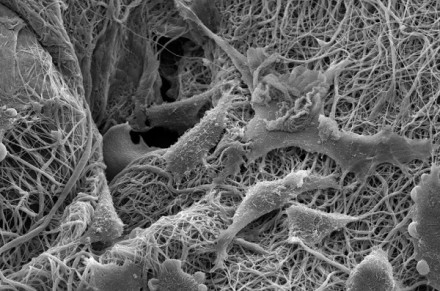 What Are Fibroblasts? Meet Your Body’s Gentle Healers!